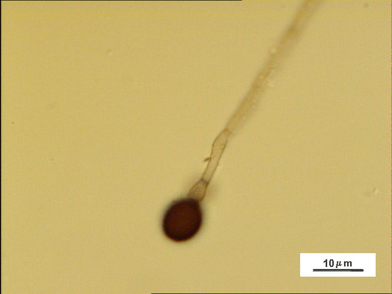Trichocladium alopallonellum (Meyers & Moore) Kohlm